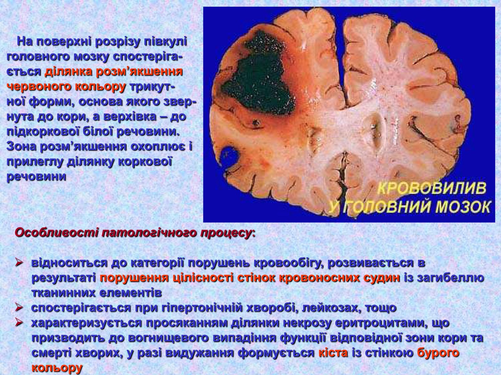 Патоморфологія - препарати